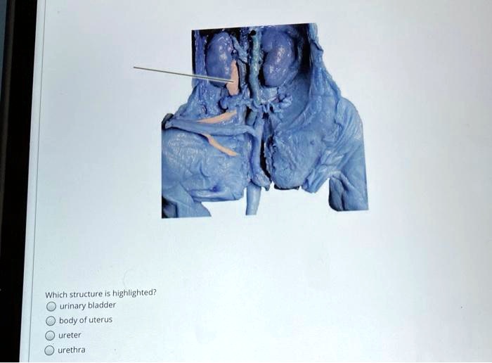 SOLVED: Which structure is highlighted? O urinary bladder, body of ...