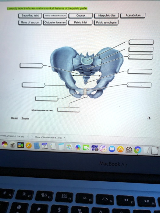 Correctly label the bones and anatomical features of the pelvic girdle ...