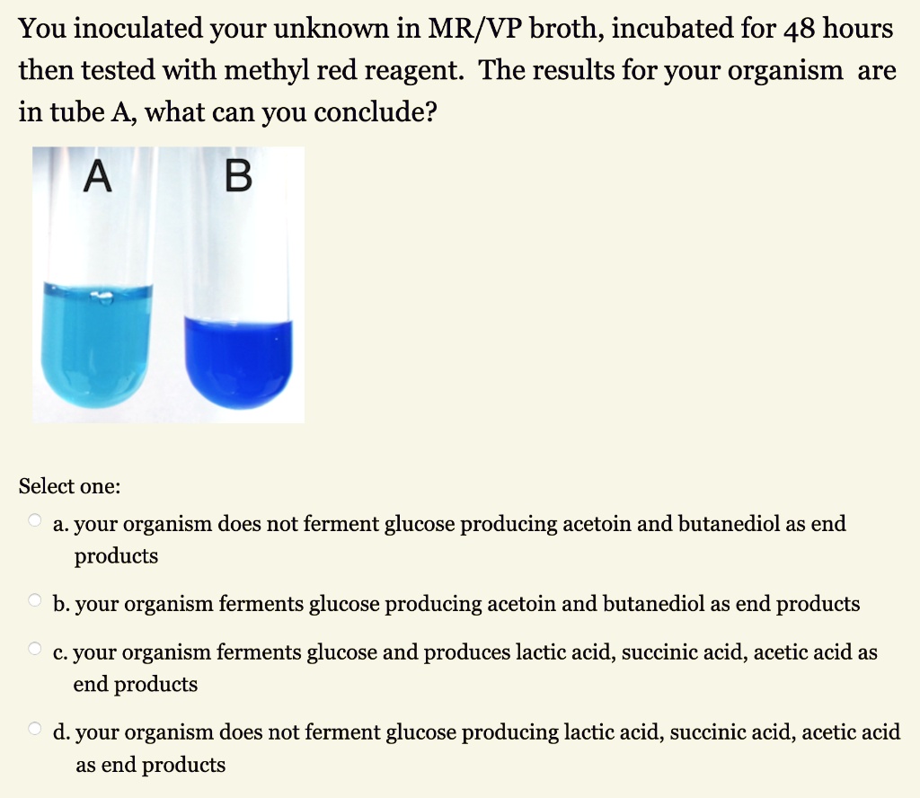 Significance Of IMViC Tests, Principle, Procedure And, 59% OFF Significance Of IMViC Tests, Principle, Procedure And, 59% OFF