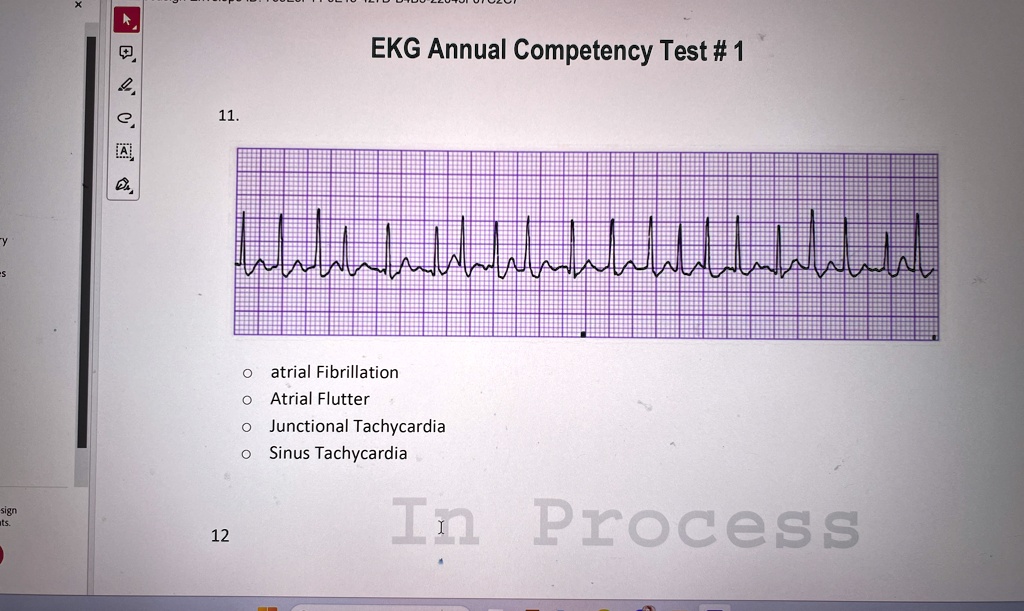 y sign ts 11 12 ekg annual competency test 1 atrial fibrillation atrial ...