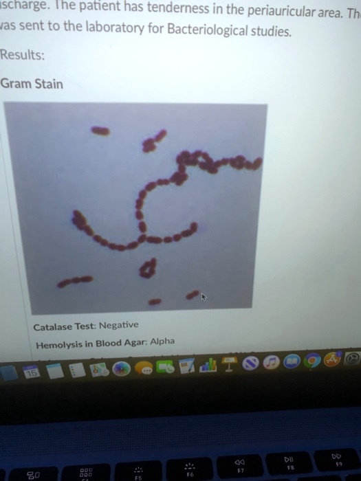 scharge. The patient has tenderness in the periauricular area. Th was ...