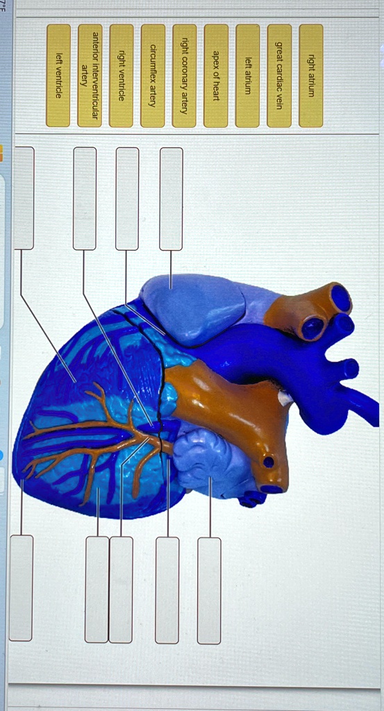 Drag the labels onto the diagram to identify the structures. left ventricle artery anterior ...