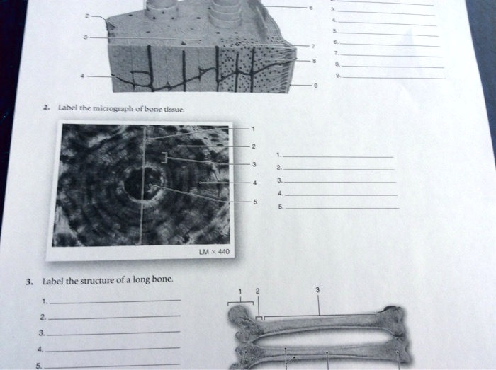 SOLVED: 2.Label the micrograph of bone tissue LMX440 3.Label the ...