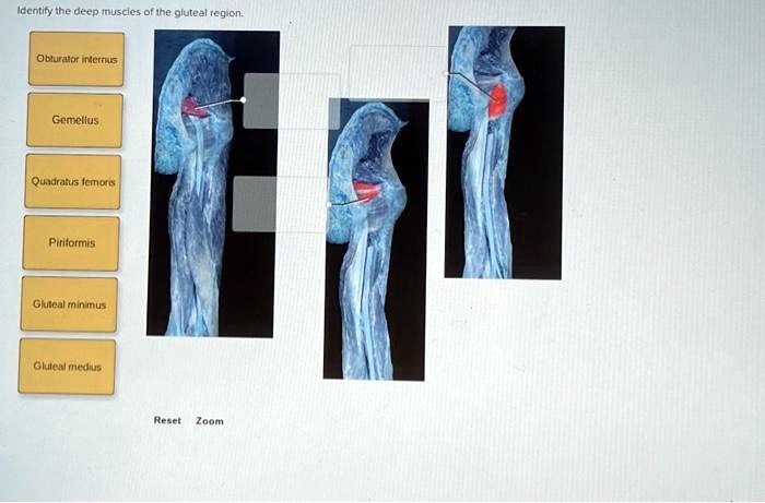 Identify the deep muscles of the gluteal region. Obturator internus ...