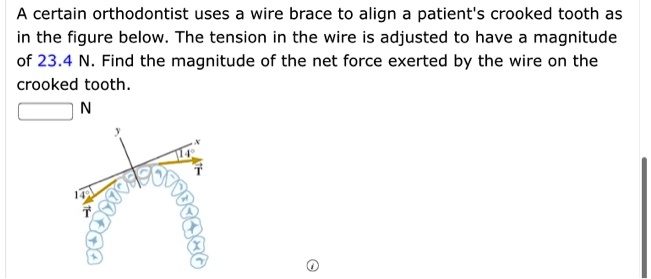 SOLVED: A certain orthodontist uses a Wire brace to align a patient's ...