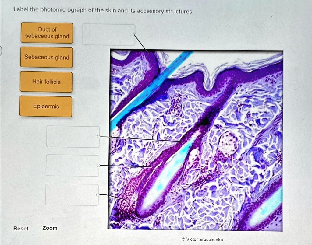 Label the photomicrograph of the skin and its accessory structures ...