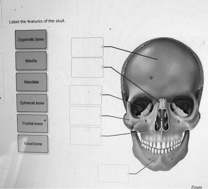 Label the features of the skull. Zygomatic bone Maxilla Mandible ...