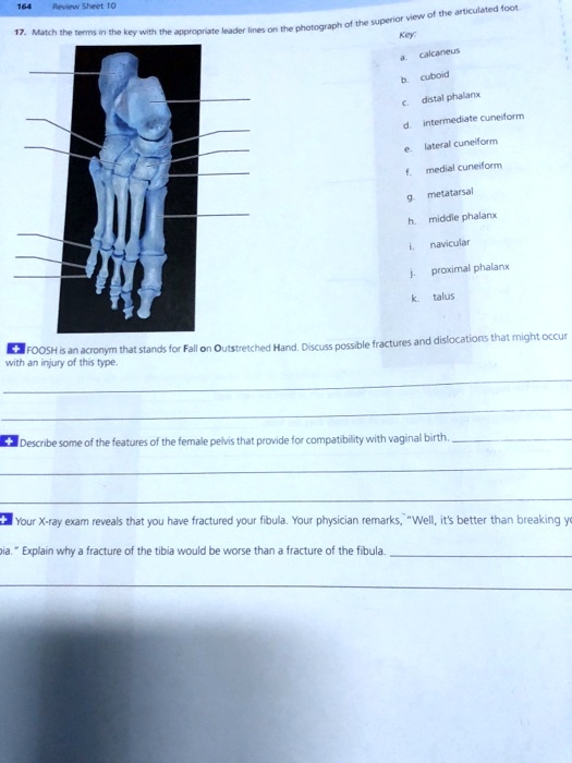 Solved Talus Sustentaculum Tali Subkalar Calcaneus From K