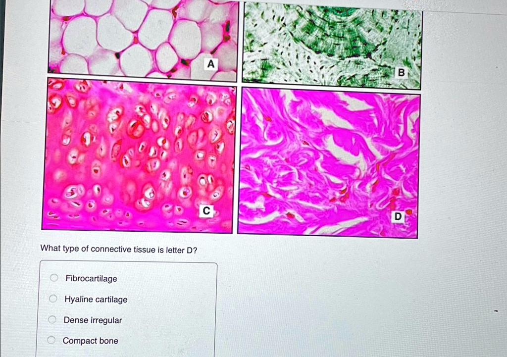 what type of connective tissue is letter d fibrocartilage hyaline ...
