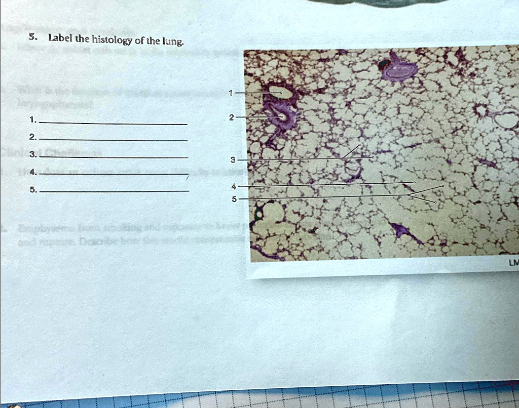 Label the histology of the lung. 5.Label the histology of the lung 1 2 3. 5