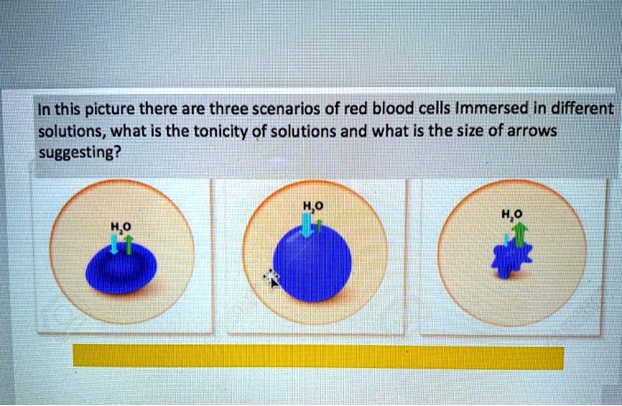 SOLVED: In this picture there are three scenarios of red blood cells ...
