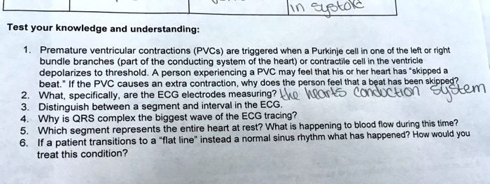 SOLVED: Premature ventricular contractions (PVCs) are triggered when a ...