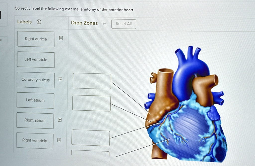 Correctly label the following external anatomy of the anterior heart ...