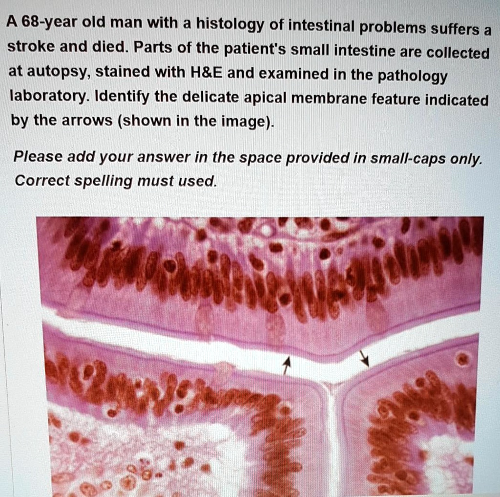 a 68 year old man with a histology of intestinal problems suffers a ...