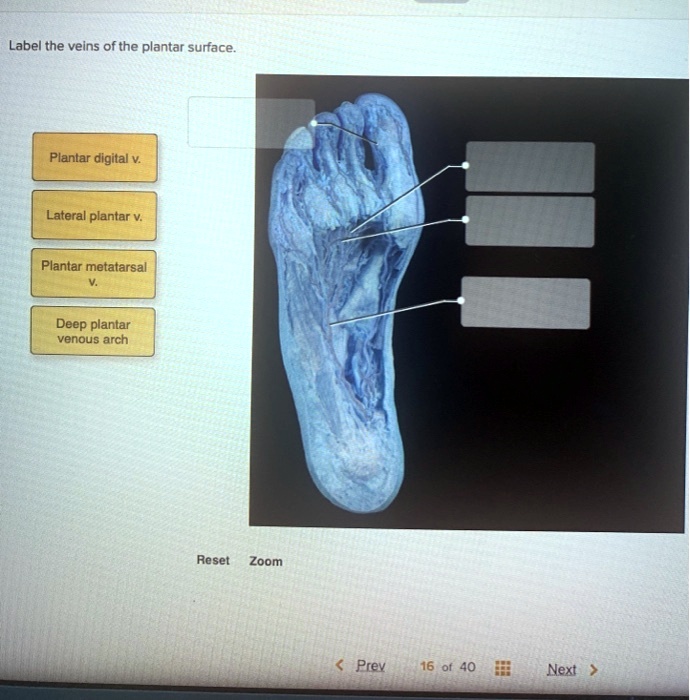 SOLVED: Label the veins of the plantar surface. Plantar digital v ...