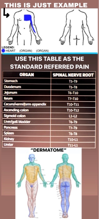 SOLVED: USE THE TABLE AS THE STANDARD FOR REFERRED PAIN IN THE PICTURE ...