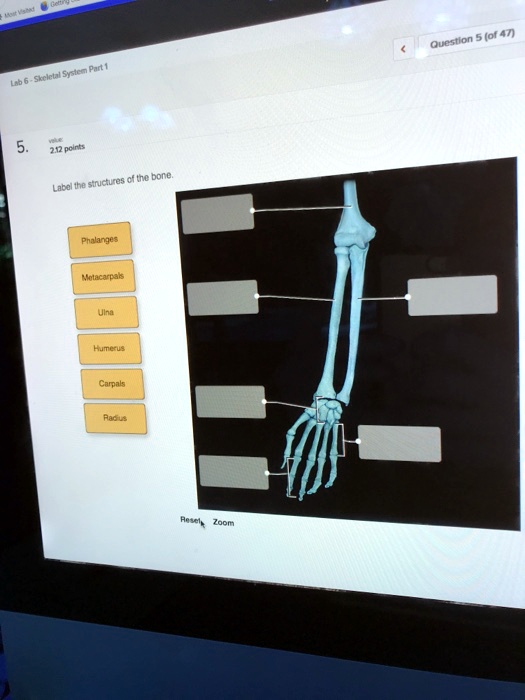 SOLVED: Question 5 (of 47) Lab 6 - Skeletal System Part 1 5. 2.12 points Label the structures of ...