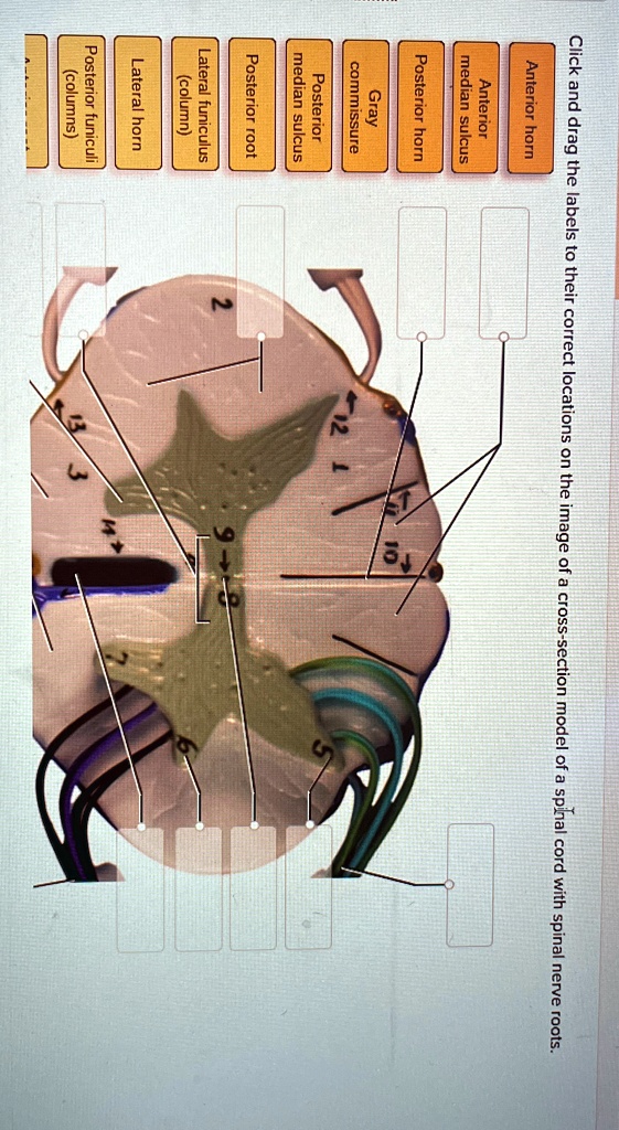 Click and drag the labels to their correct locations on the image of a ...