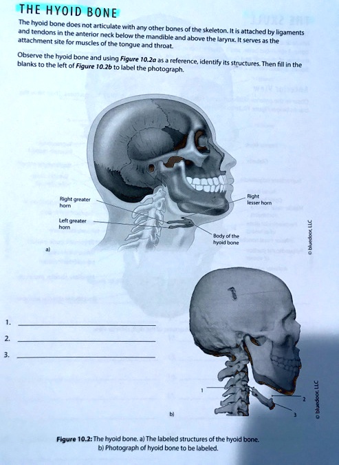 THE HYOID BONE The hyoid bone does not articulate with any other bones ...