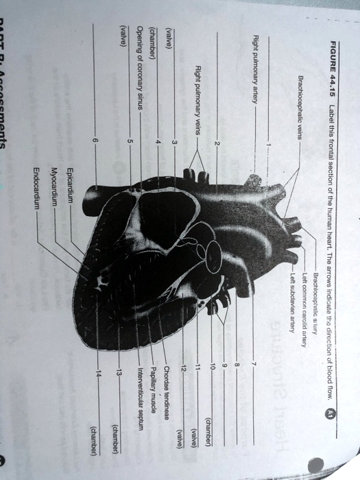 FIGURE 44.15 Label this frontal section of the human heart. The arrows ...