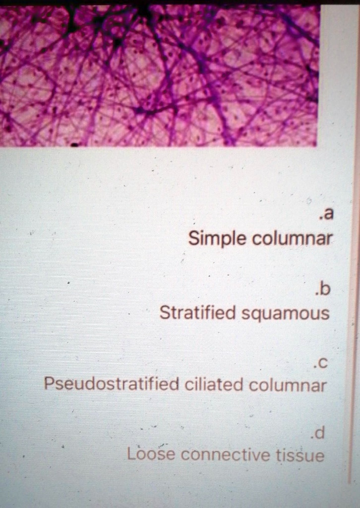 SOLVED: a Simple columnar b Stratified squamous C Pseudostratified ciliated columnar d Loose ...