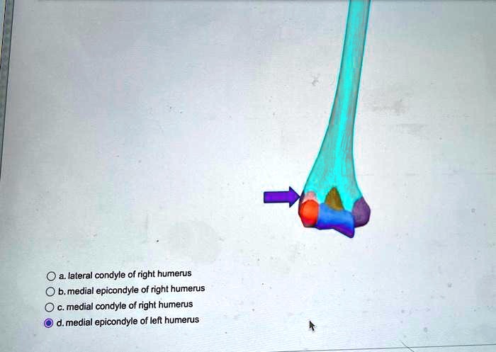 SOLVED: a. Lateral condyle of right humerus b. Medial epicondyle of ...