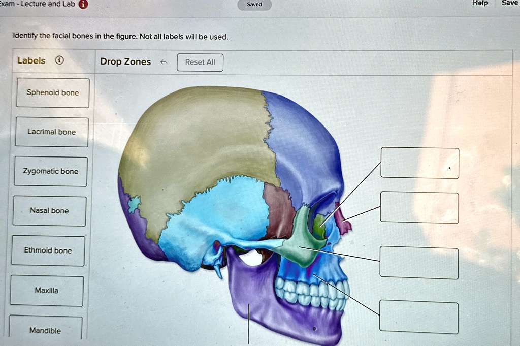 Exam - Lecture and Lab Identify the facial bones in the figure. Not all ...