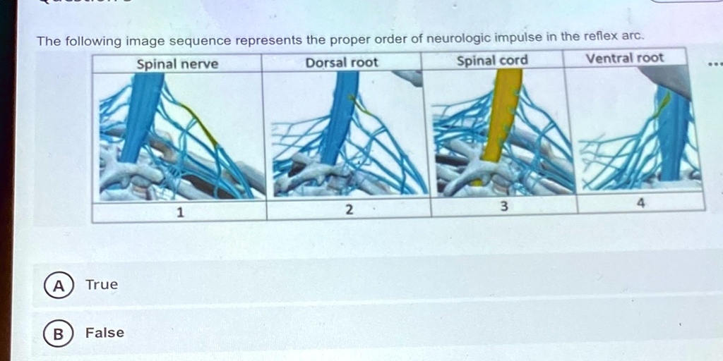SOLVED: 'The following image sequence represents the proper order of neurologic impulse in the ...