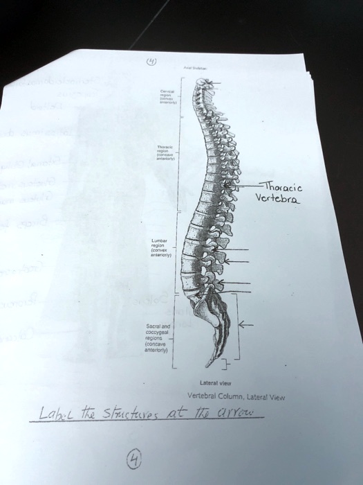 SOLVED: Thoracic Vertebra Lateral view Vertebral Column, Lateral View ... SOLVED: Thoracic Vertebra Lateral view Vertebral Column, Lateral View ...