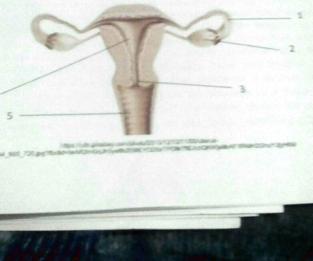 SOLVED: Label the parts of the female reproductive system. Please help ...