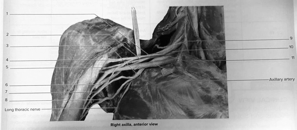 1 2 3 4 5 6 7 8 Long thoracic nerve Right axilla, anterior view 9 10 11 ...