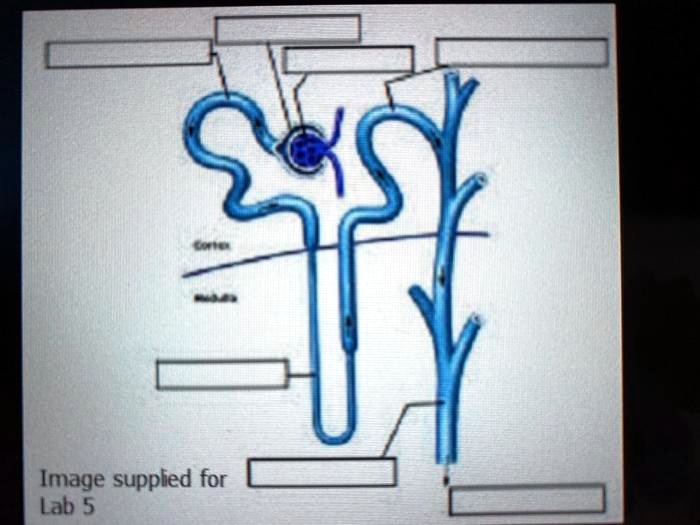 SOLVED: Label the Nephron