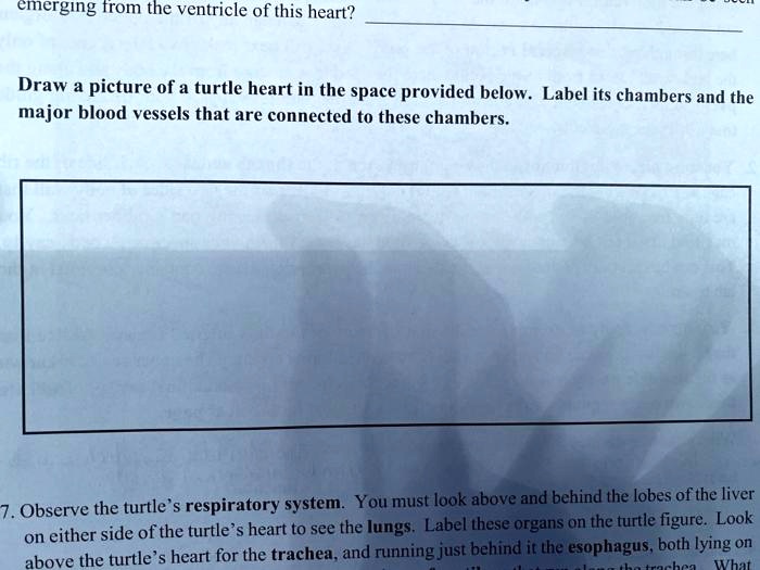 Emerging from the ventricle of this heart draw a picture of...