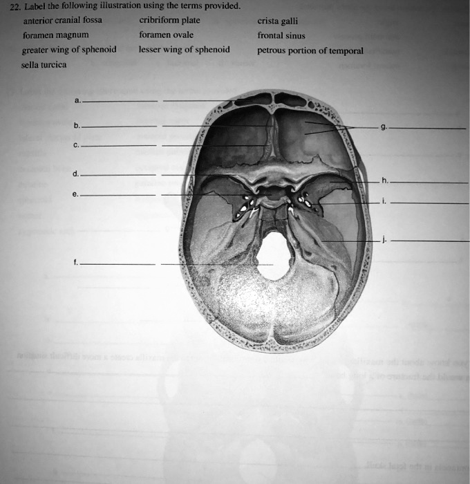 22. Label the following illustration using the terms provided. anterior ...