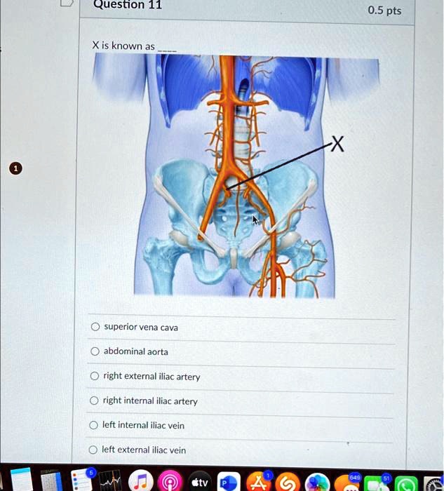 X is known as X superior vena cava abdominal aorta right external iliac ...