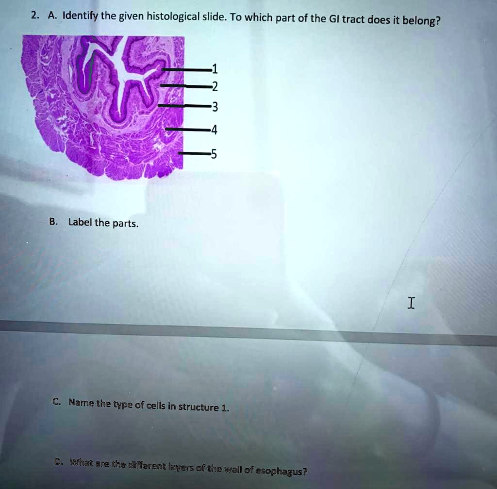 SOLVED: 2. A. Identify the given histological slide. To which part of the GI tract does it ...