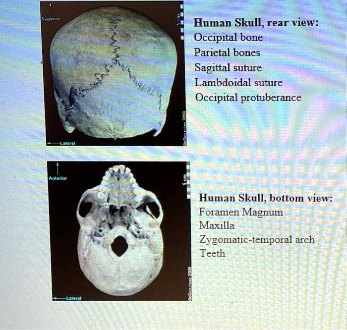 human skull rear view occipital bone parietal bones sagittal suture ...