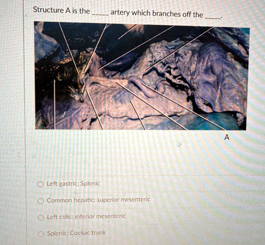 Structure A is the artery which branches off the Left gastric; Splenic ...