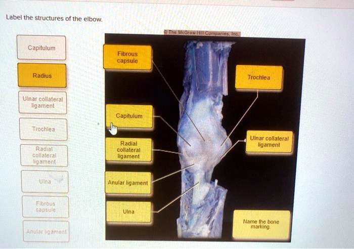 Label the structures of the elbow. Capitulum Fibrous capsule Radius The ...