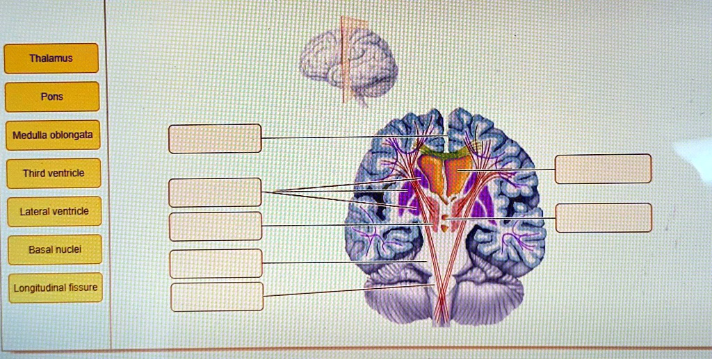 SOLVED: Thalamus Pons Medulla oblongata Third ventricle Lateral ...