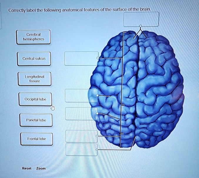 SOLVED: Correctly label the following anatomical features of the surface of the brain ...