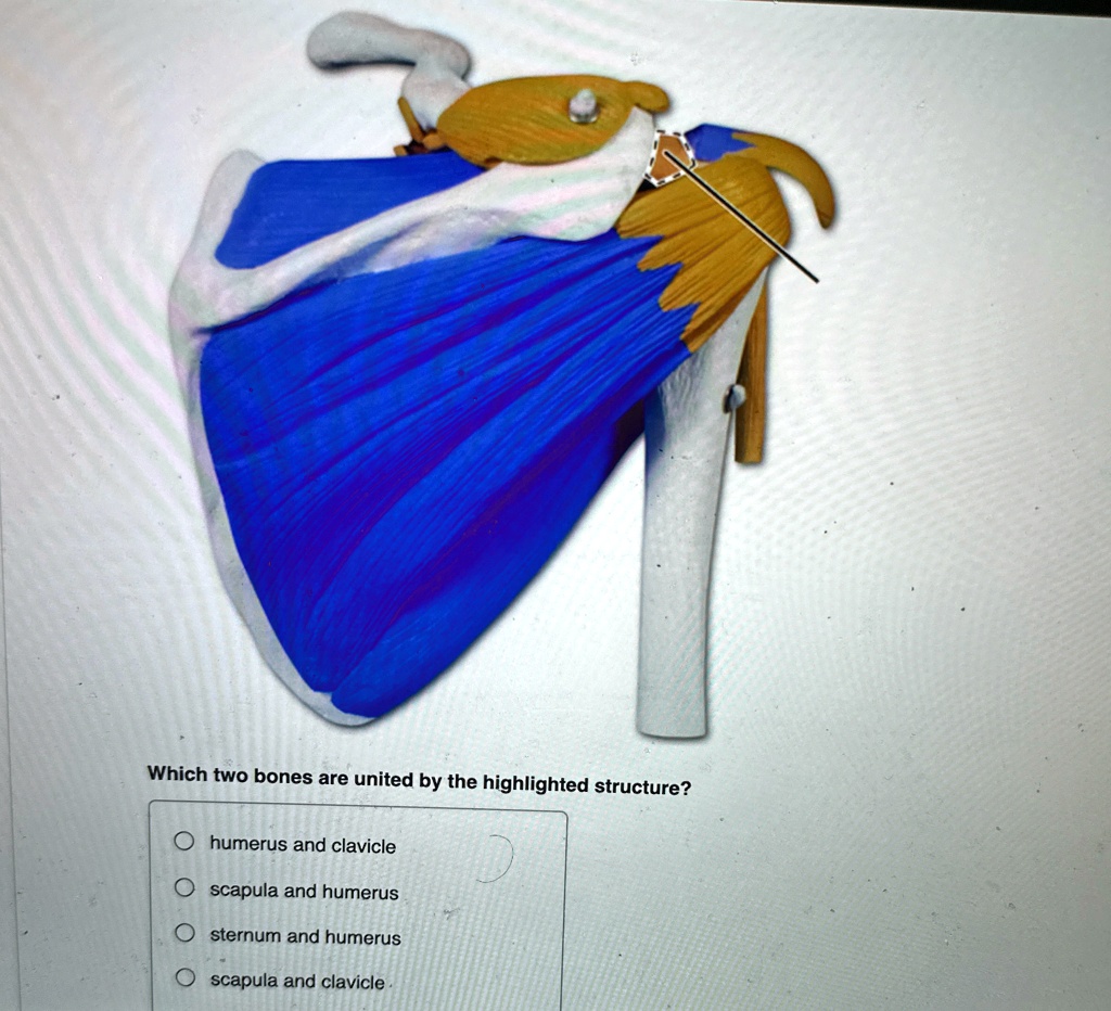 [GET ANSWER] Which two bones are united by the highlighted structure ...