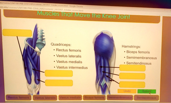 SOLVED: Muscles That Move the Knee Joint Quadriceps: Rectus femoris ...