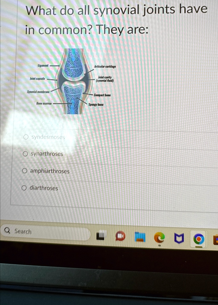 What do all synovial joints have in common? They are: Ligament ...