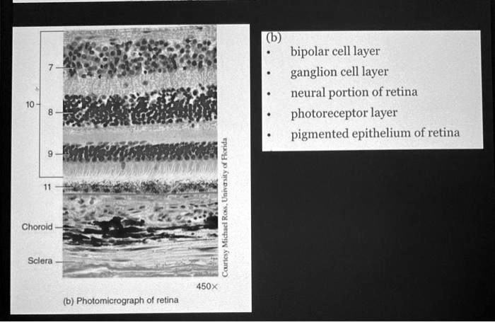 10 8 11 Choroid Sclera 9 7 450x (b) Photomicrograph of retina Courtesy ...