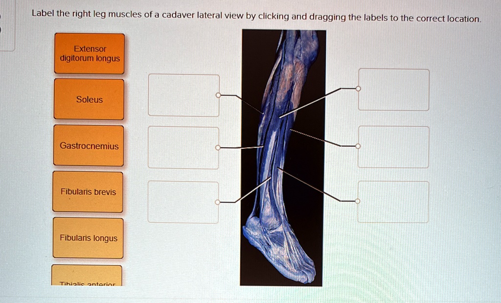 Label the right leg muscles of a cadaver lateral view by clicking and ...