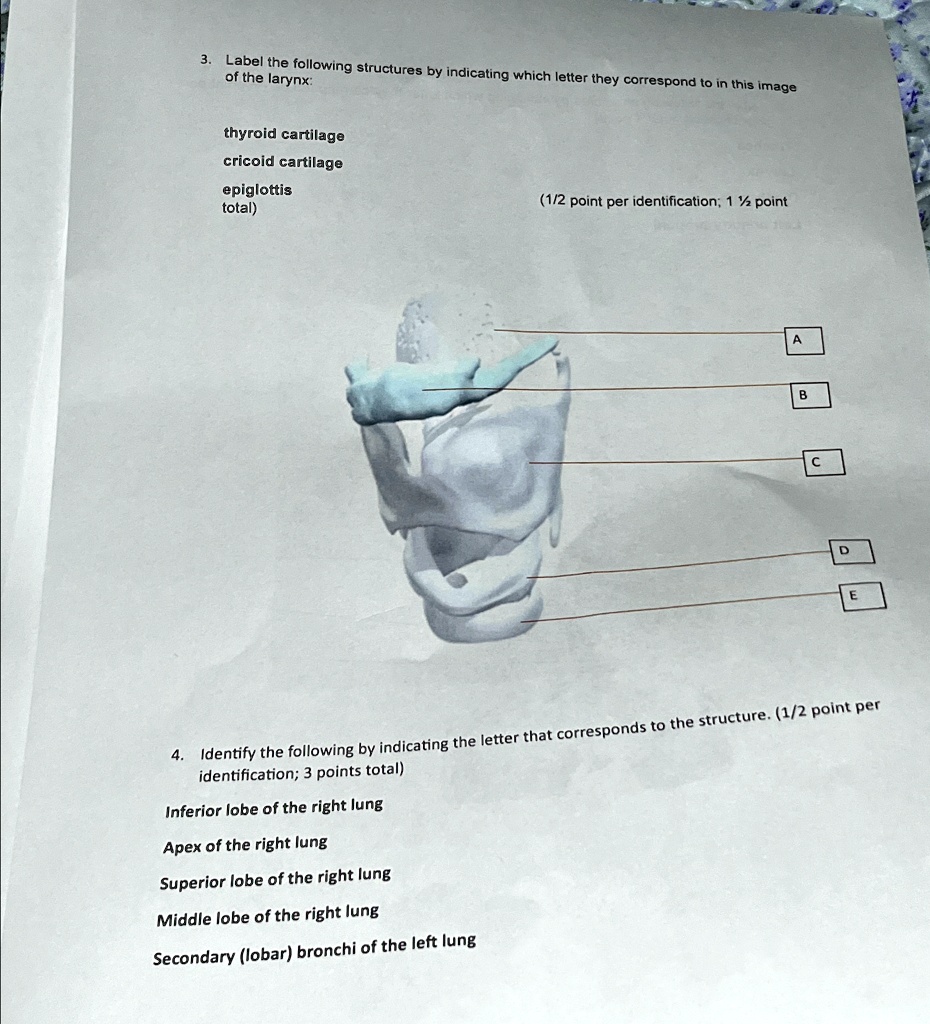 Label the following structures by indicating which letter they correspond to in this image of ...