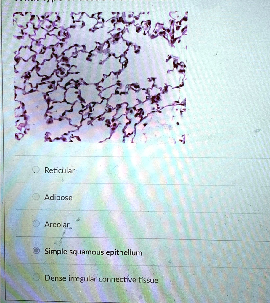 SOLVED: Reticular Adipose Areolar Simple squamous epithelium Dense ...