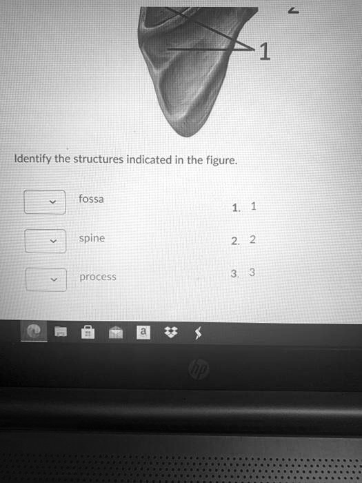 identify the structures indicated in the figure fossa spine process 27726 identify the structures indicated in the figure fossa spine process 27726