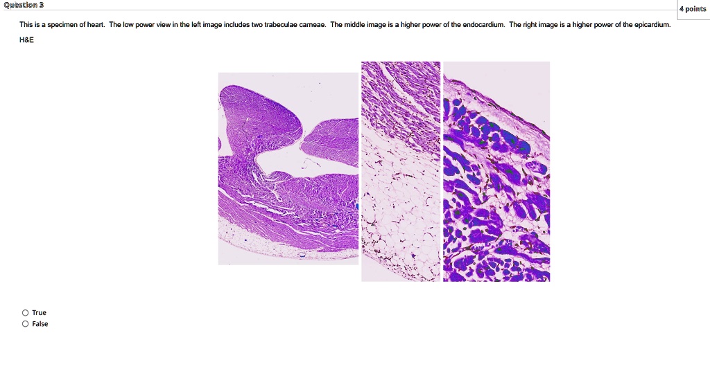 Trabeculae Carneae Histology